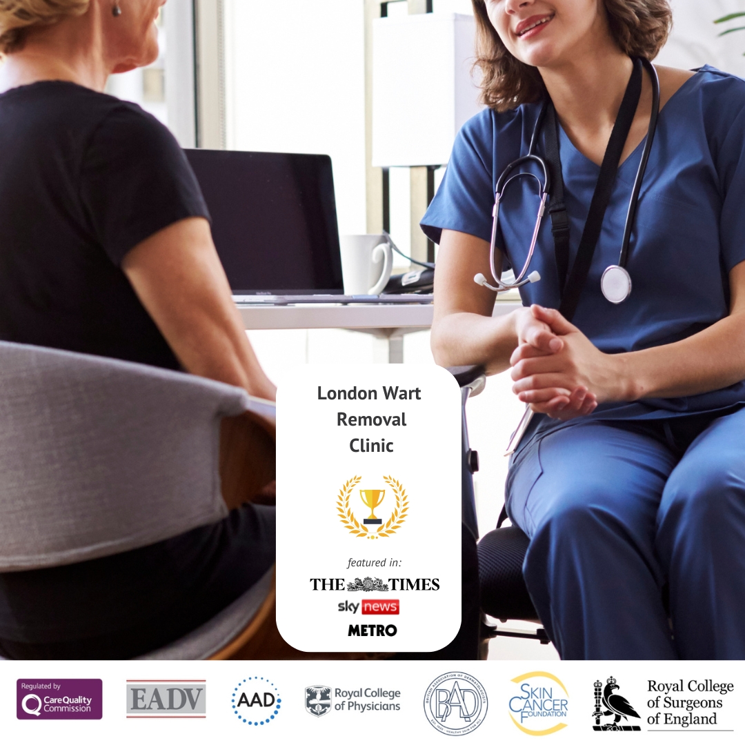 Filiform Wart Removal Treatment London Wart Clinic